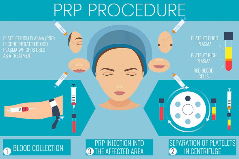 PRP Stem Cell Therapy | Innovative rejuvenating treatments